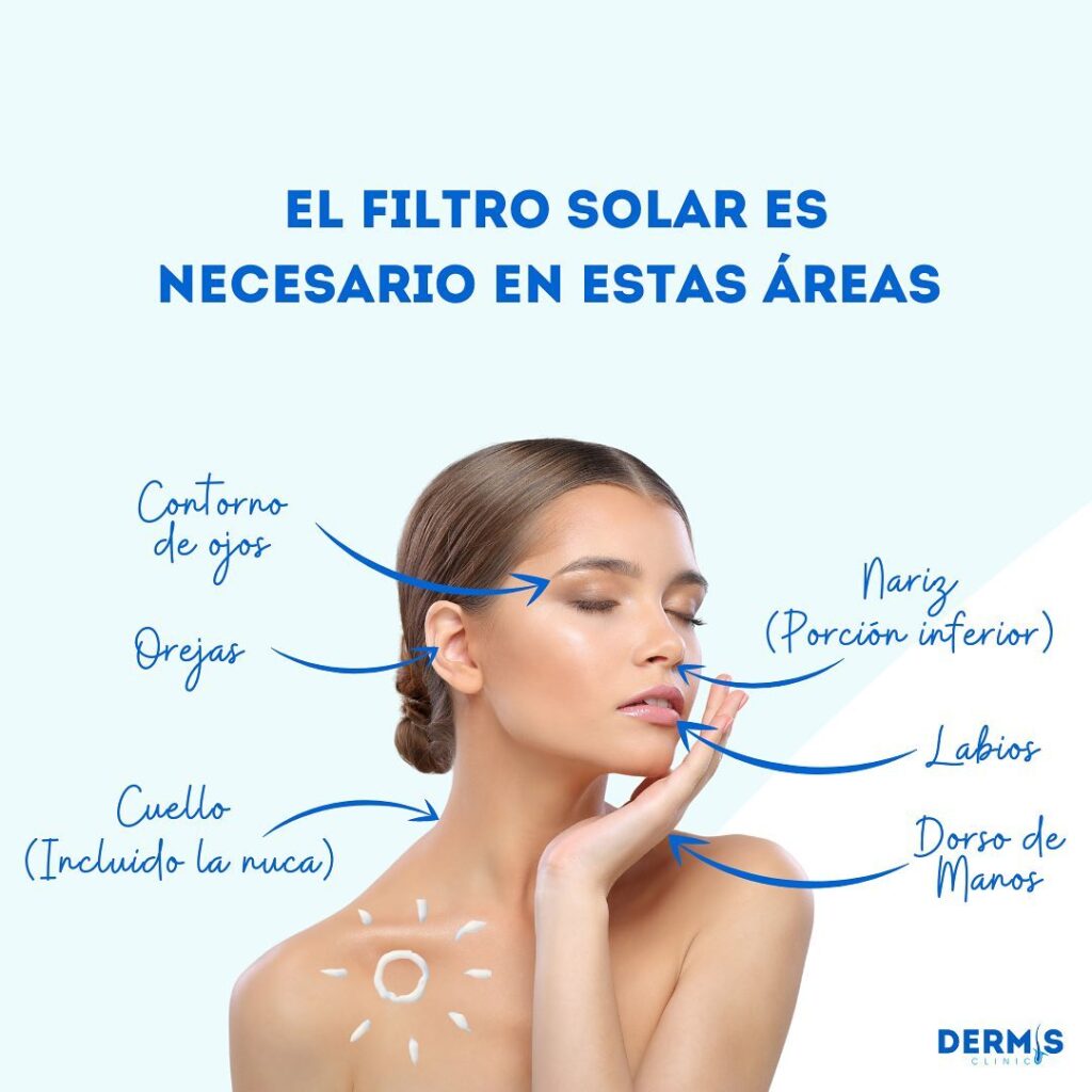 El filtro solar es necesario en estas áreas - DERMIS CLINIC